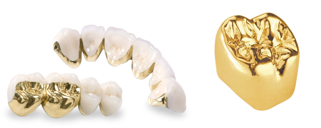 Crown & Bridge Dental Lab - Next Dental Lab