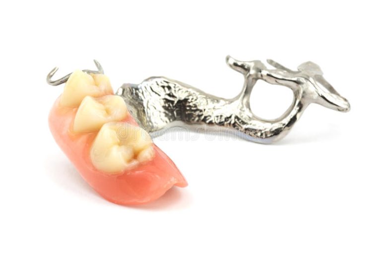 Removable Dentures and Partials - Next Dental Lab