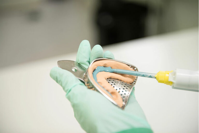 4 Common Dental Impression Errors & How to Fix Them
