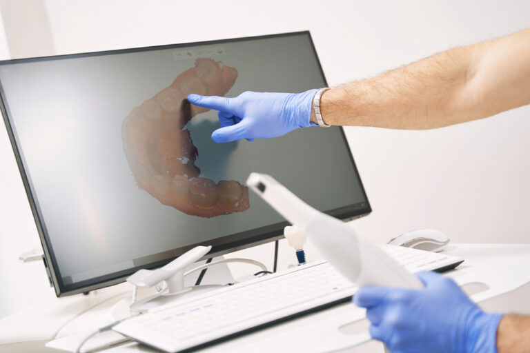 4 Things To Know About Digital Scan For Dentures - Next Dental Lab